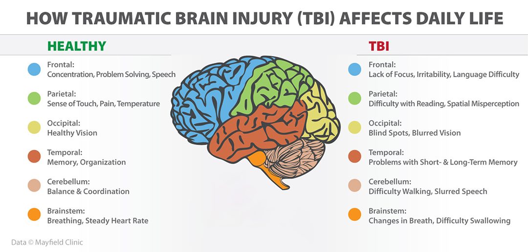 March Is Brain Injury Awareness Month Twin Forks Optometry